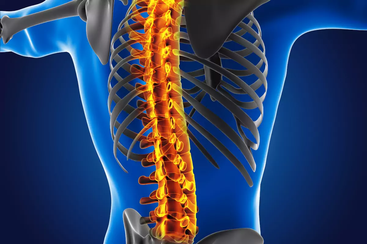 What is Nerve Impingement Syndrome? - Hickory Grove Chiropractic